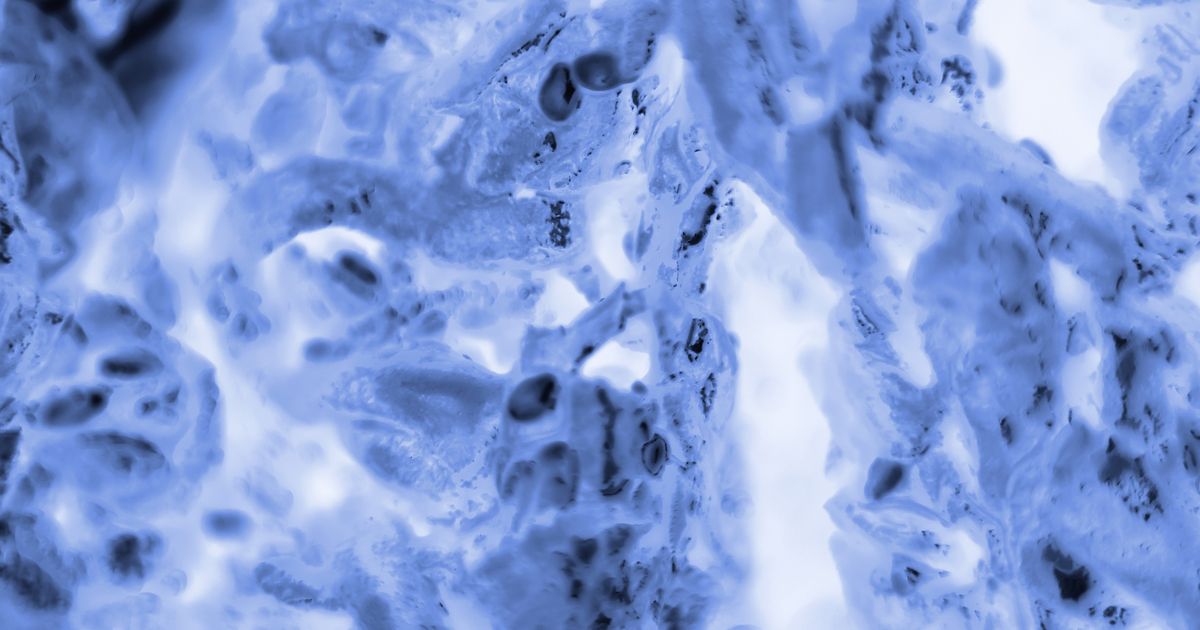 European Consortium Seeks to Develop Liquid Biopsy Test for Prostate ...