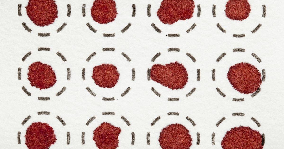 Swedish Researchers Use Olink Tech for Proteomic Analysis of Home ...