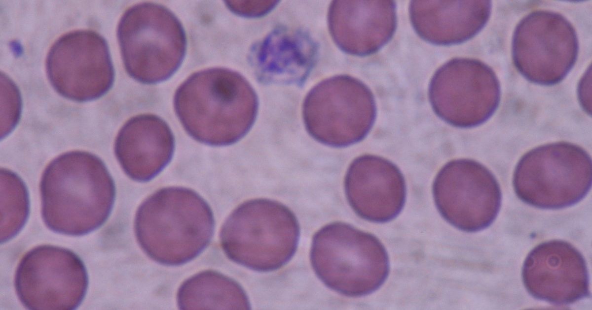 Dutch Team Refining Blood-Based Dx Platform Acquired by Illumina Last ...
