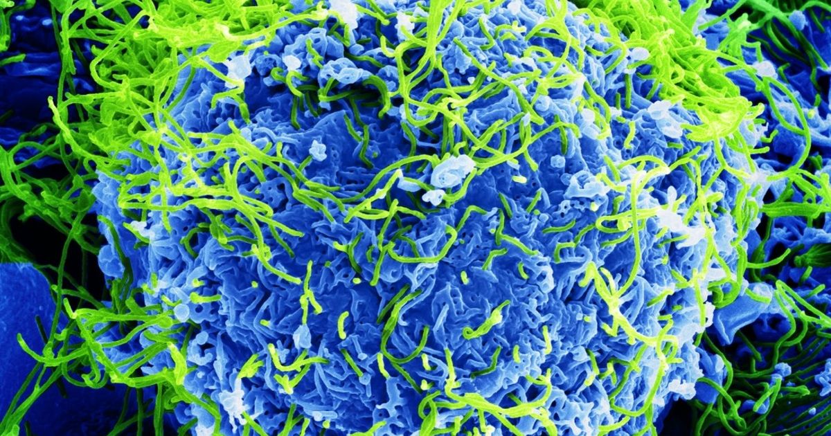 Ebola Virus Appears to Undergo Distinct Changes in Bat, Human Host Cell ...