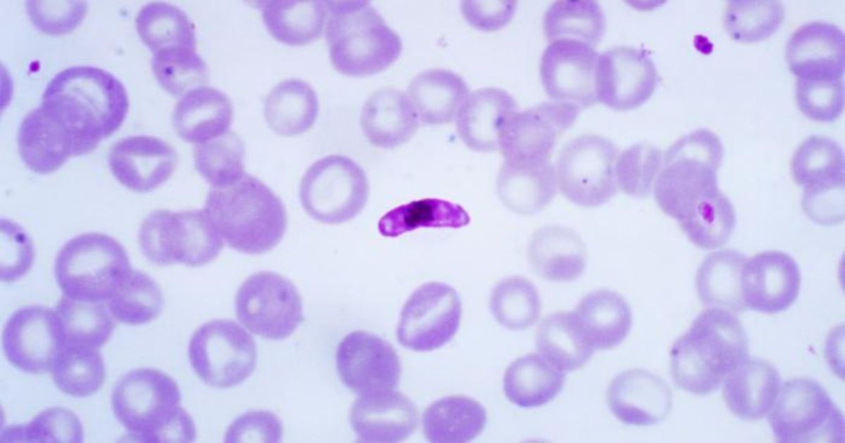 Malaria Cell Atlas Tracks Parasite Activity With Single-Cell Transcriptomes | GenomeWeb