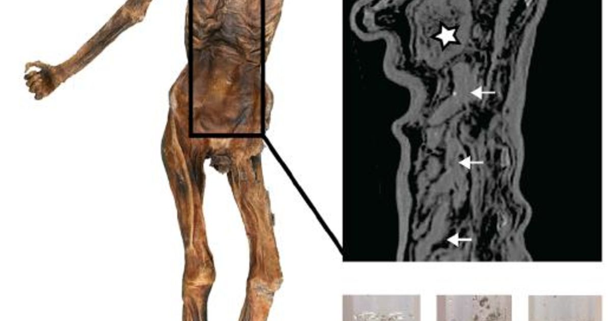 Omic, Microscopic Analysis Elucidates Otzi's Last Meal | GenomeWeb