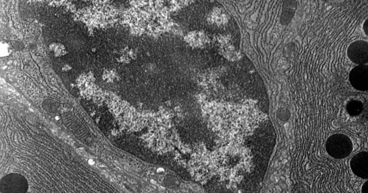 Single-Nucleus Sequencing Holds High Risk, High Reward for ...