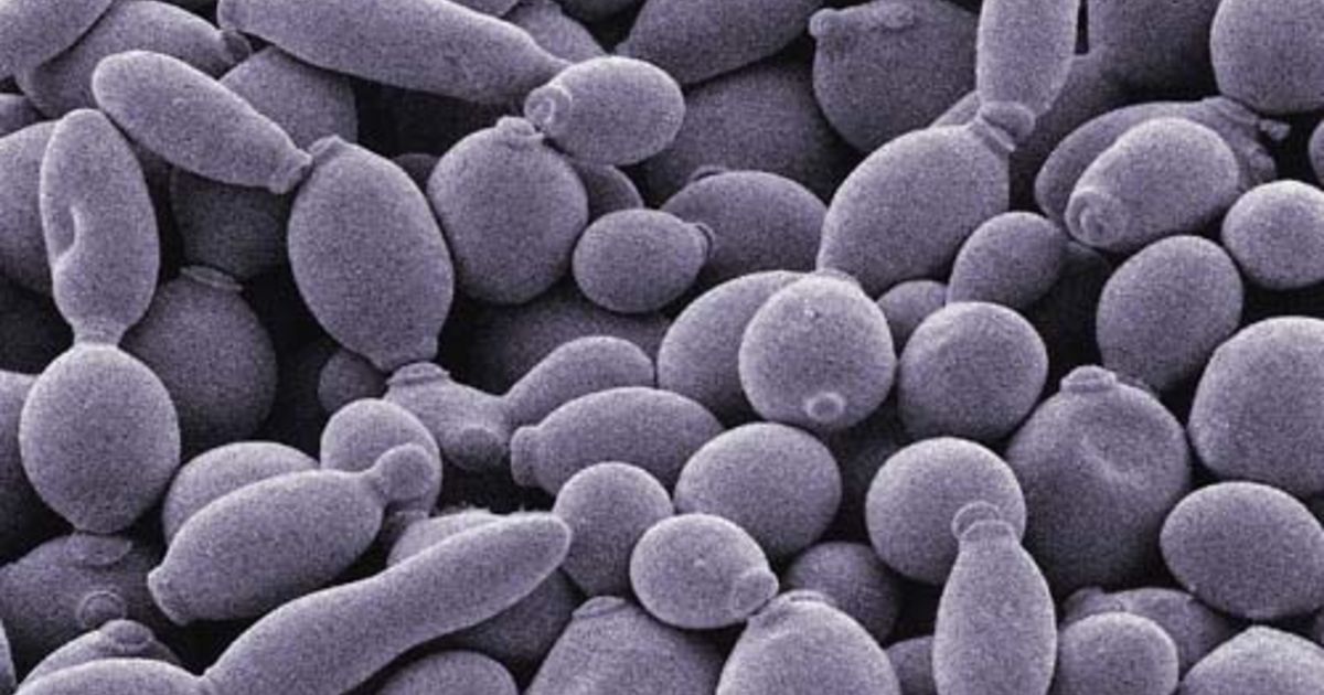 Machine Learning Predicts Yeast Metabolome Based on Protein Expression ...