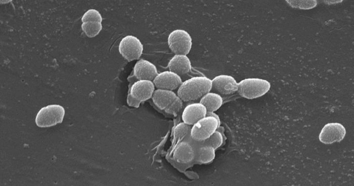 Study Points to Microbial Pioneers Behind Infant Gut Microbiome ...