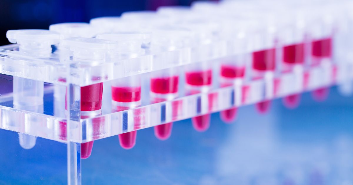 Exai Bio Commercializing Noncoding RNA Method for Liquid Biopsy ...