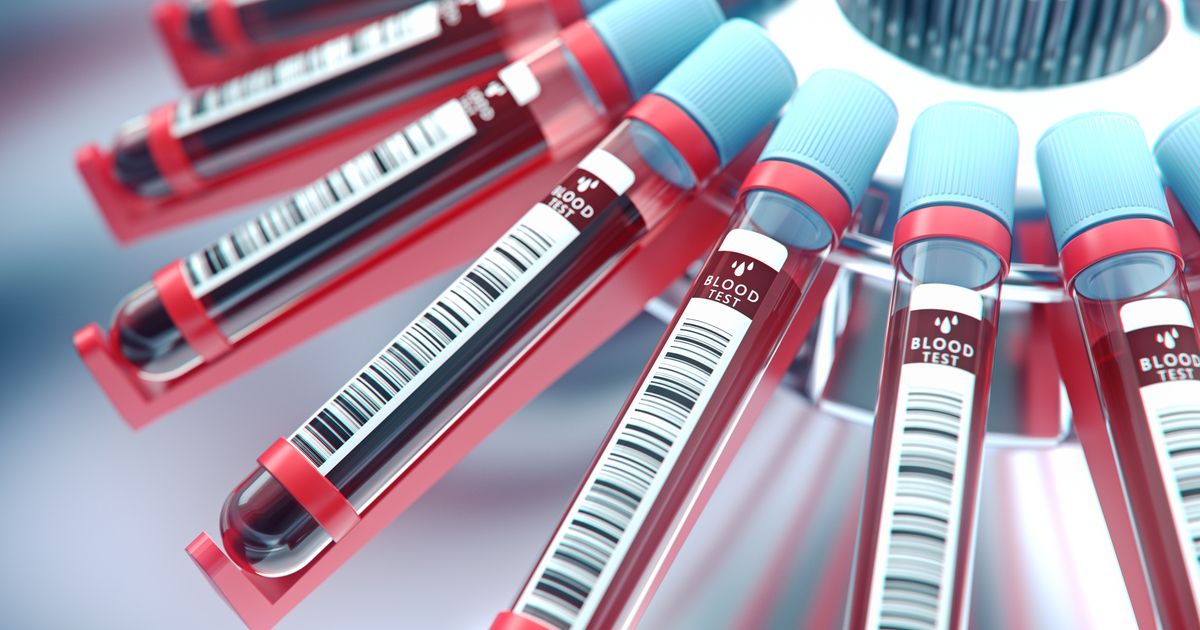New Multi-Cancer Detection Data Speak to Both Promises and Cautions of ...