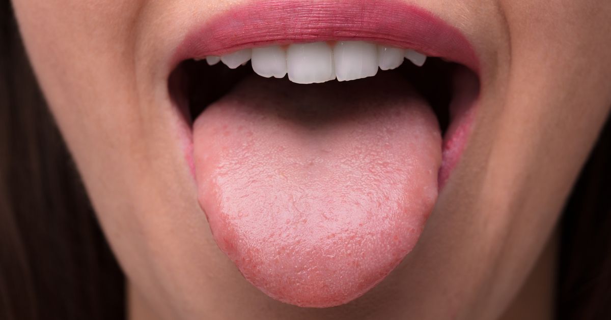Bitter Taste Receptor Variant Correlates With COVID-19 Clinical Course ...