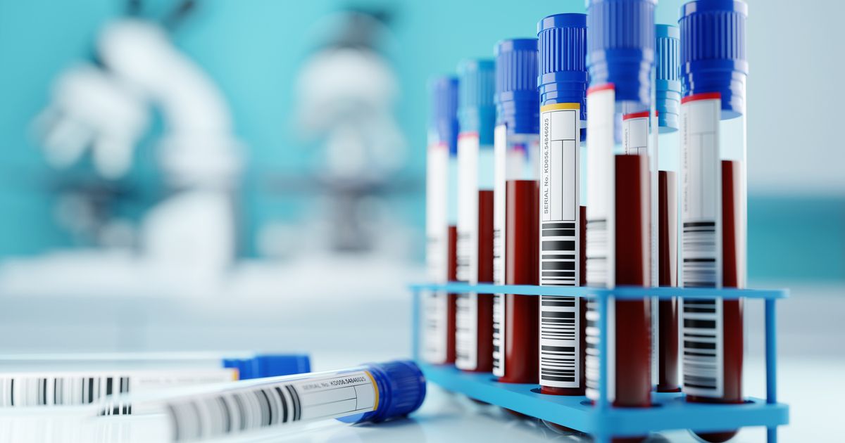 Users of Blood-Based MRD Testing for Solid Tumors Split on Approaches ...