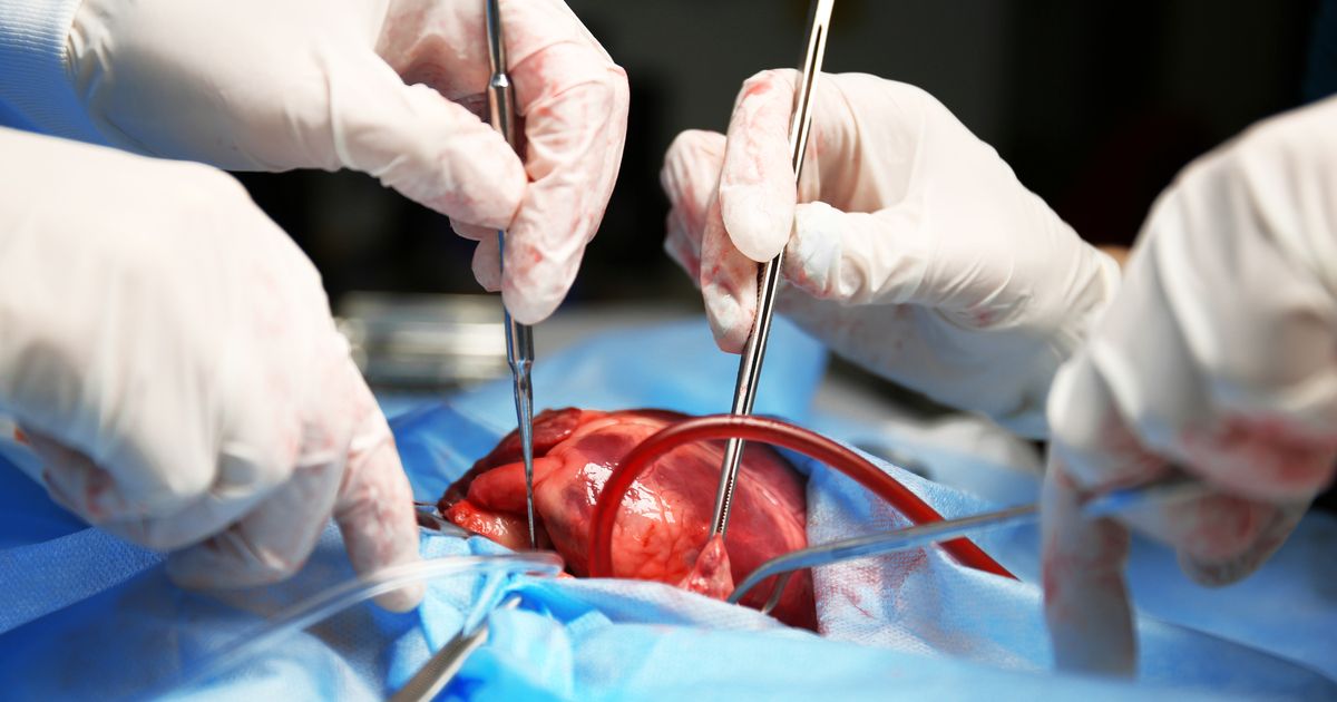 Liquid Biopsies Changing Clinical Practice for Heart Transplant Care ...