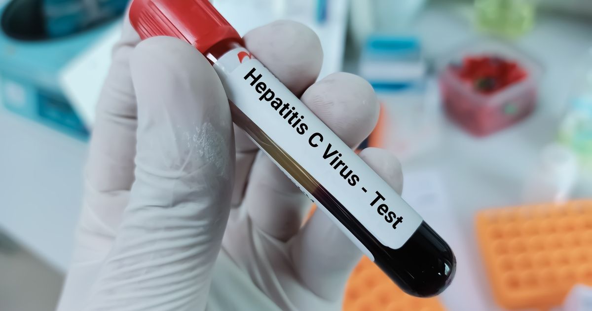 CDC Viral Hepatitis Lab for Outbreak Investigations, Diagnostics Falls ...