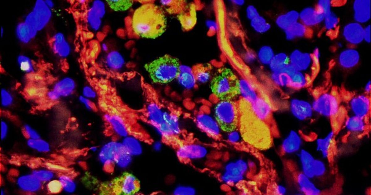 Spatial Omics Technology Survey Reveals 'Long Tail' of Interest Across ...